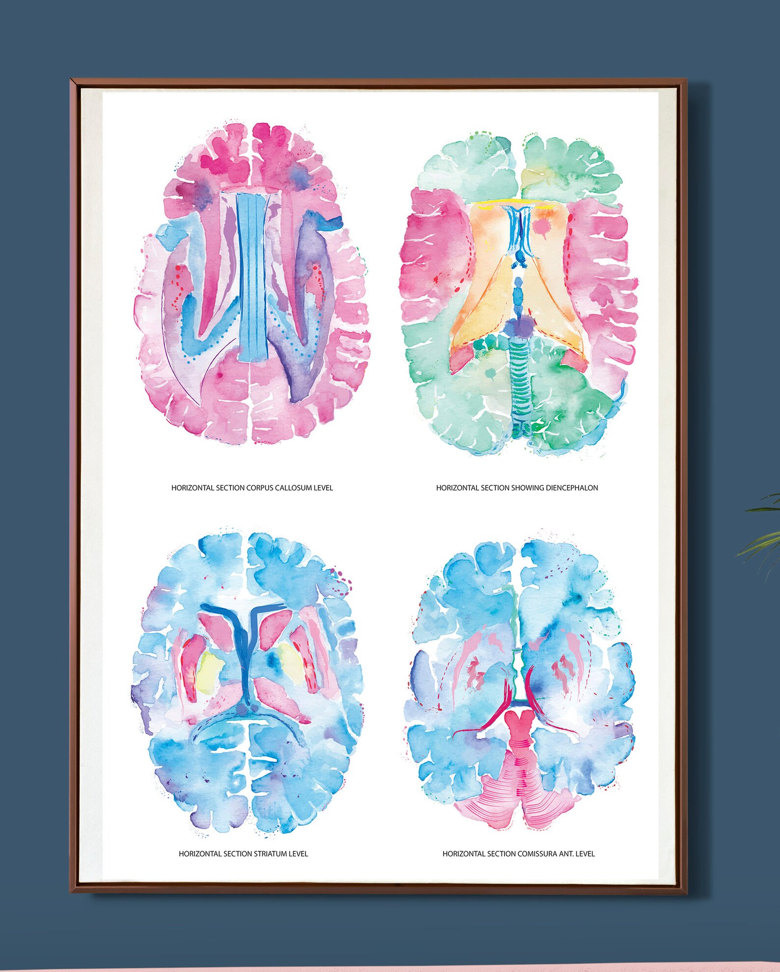 Brain Anatomy Art Neuroscience Art Neurology Art Neurology - Etsy