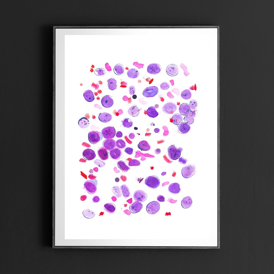 Acute Lymphoblastic Leukemia, Leukemia Art, Oncologist Gift, Hematology ...
