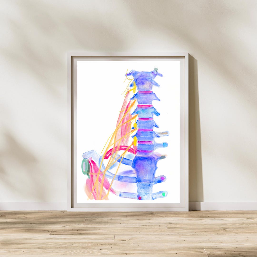 Brachial Plexus Anatomy Art Print, Anesthesiology Art, Neurology ...