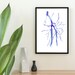 Femoral Artery Angiography, Vascular Surgeon Gift, Radiology Art ...