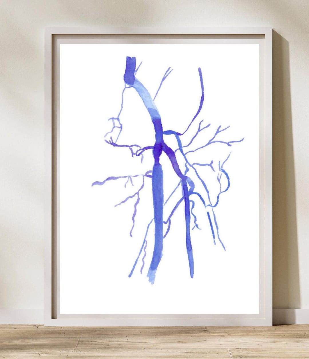 Femoral Artery Angiography, Vascular Surgeon Gift, Radiology Art ...