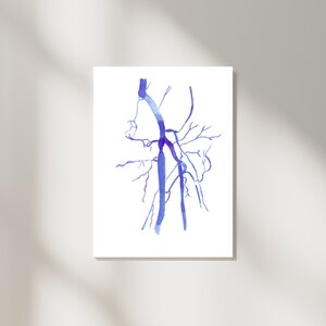 Femoral Artery Angiography, Vascular Surgeon Gift, Radiology Art ...