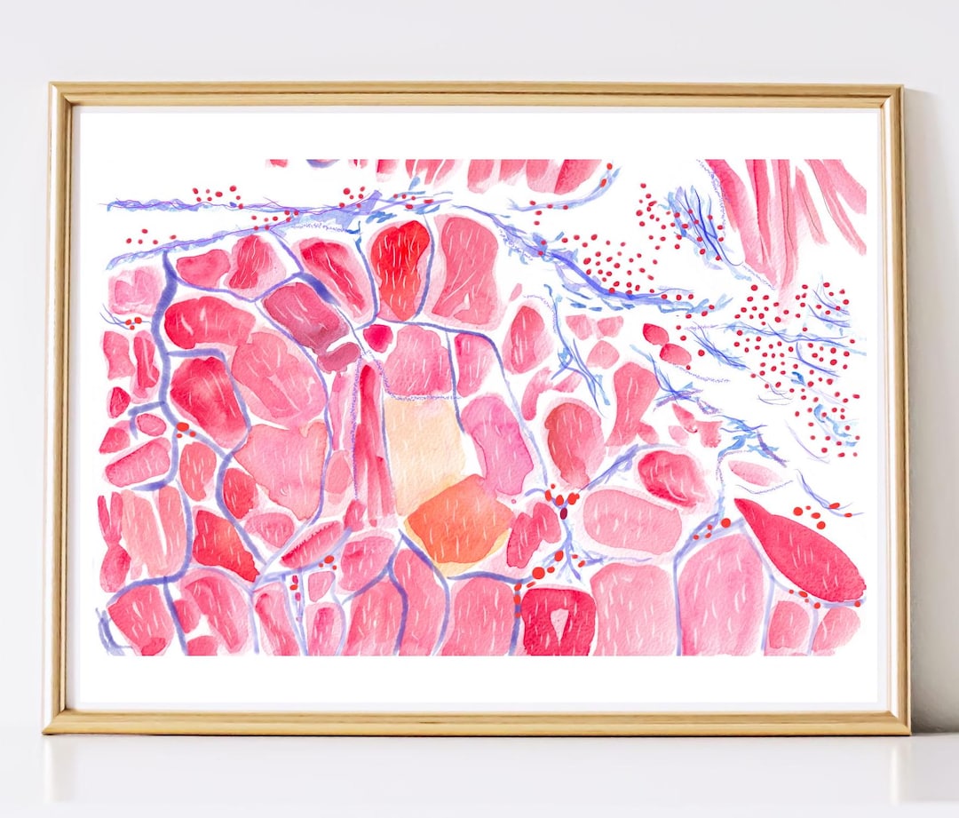 Skeletal Muscle, Histology Print, Histology Art, Pathology Art ...