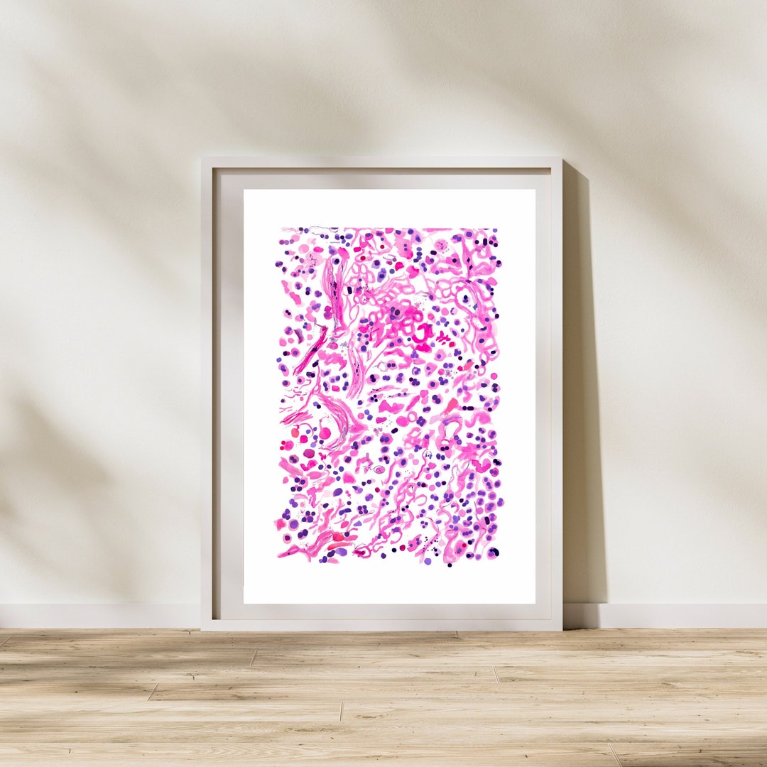 Pneumonia, Pathology Art, Pathology Assistant Gift, Histology Art, Lung ...
