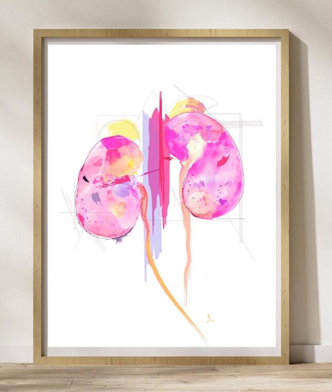 Kidney Art, Kidney Transplant, Nephrology Nurse Gift, Dialysis Nurse ...