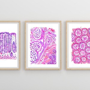 Colon Histology and Pathology Watercolor Art Print, Pathology Wall Art ...