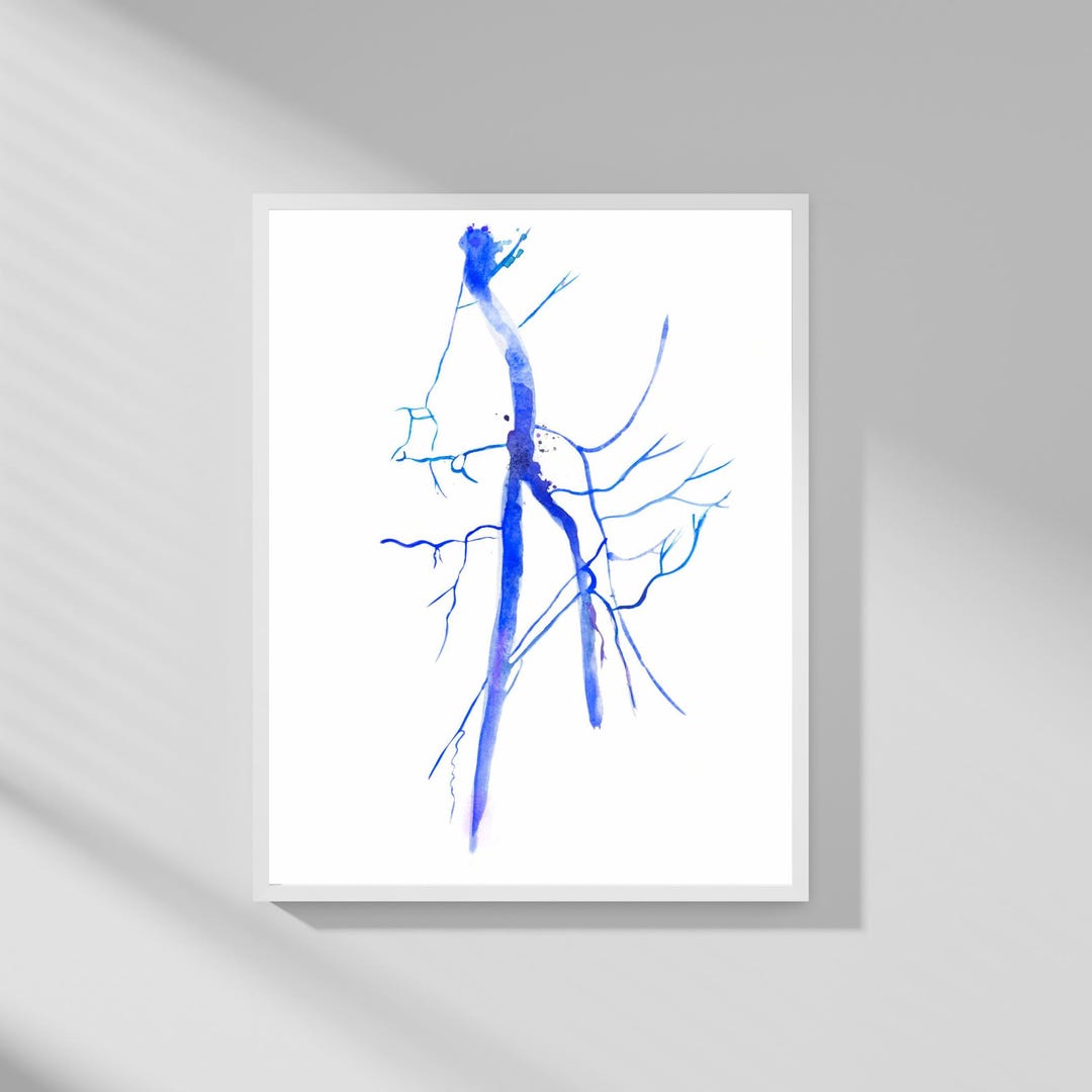 Femoral Artery Angiography, Vascular Surgeon Gift, Radiology Art ...
