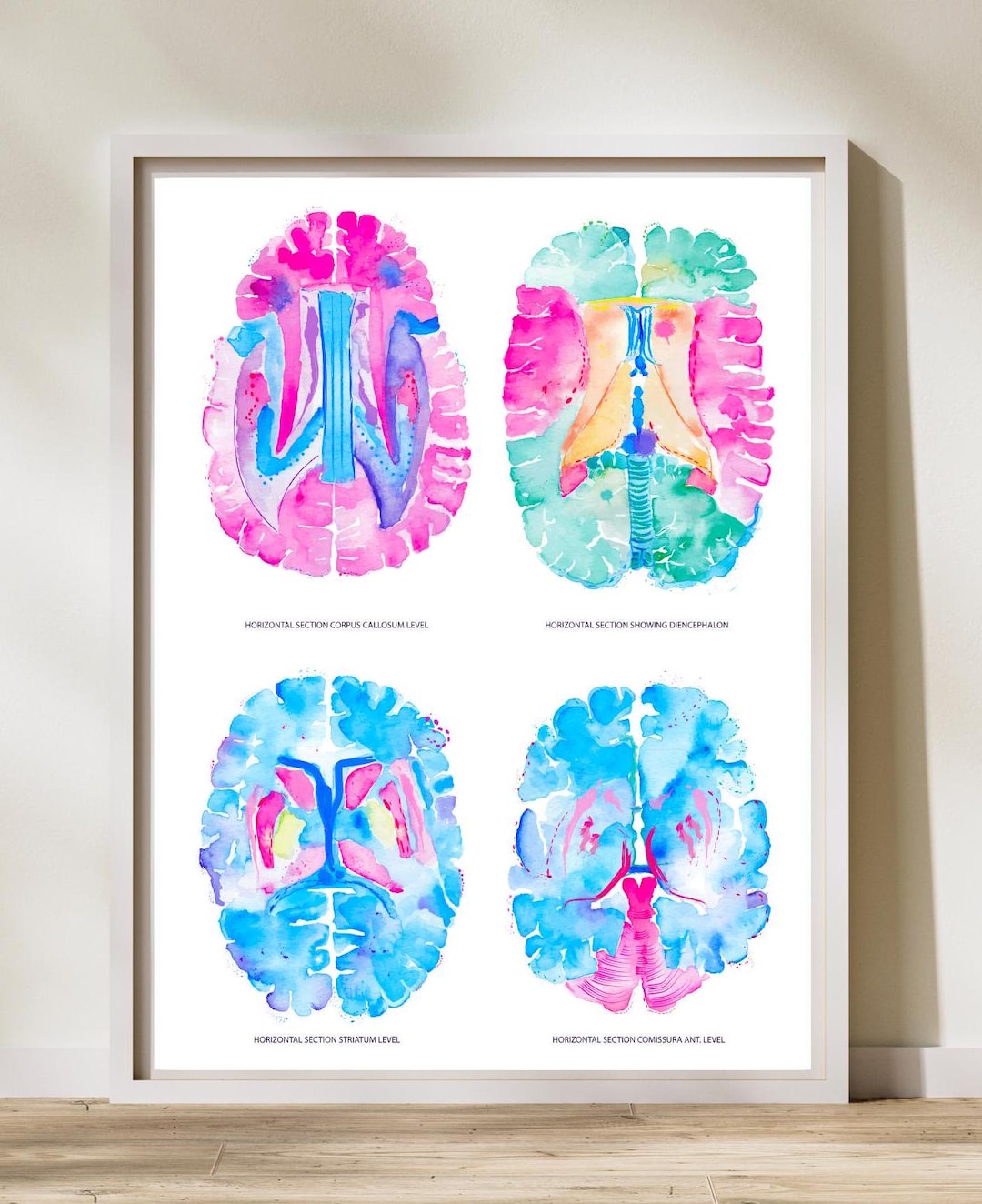 Brain Anatomy Art, Neuroscience Art, Neurology Art, Neurology Office ...