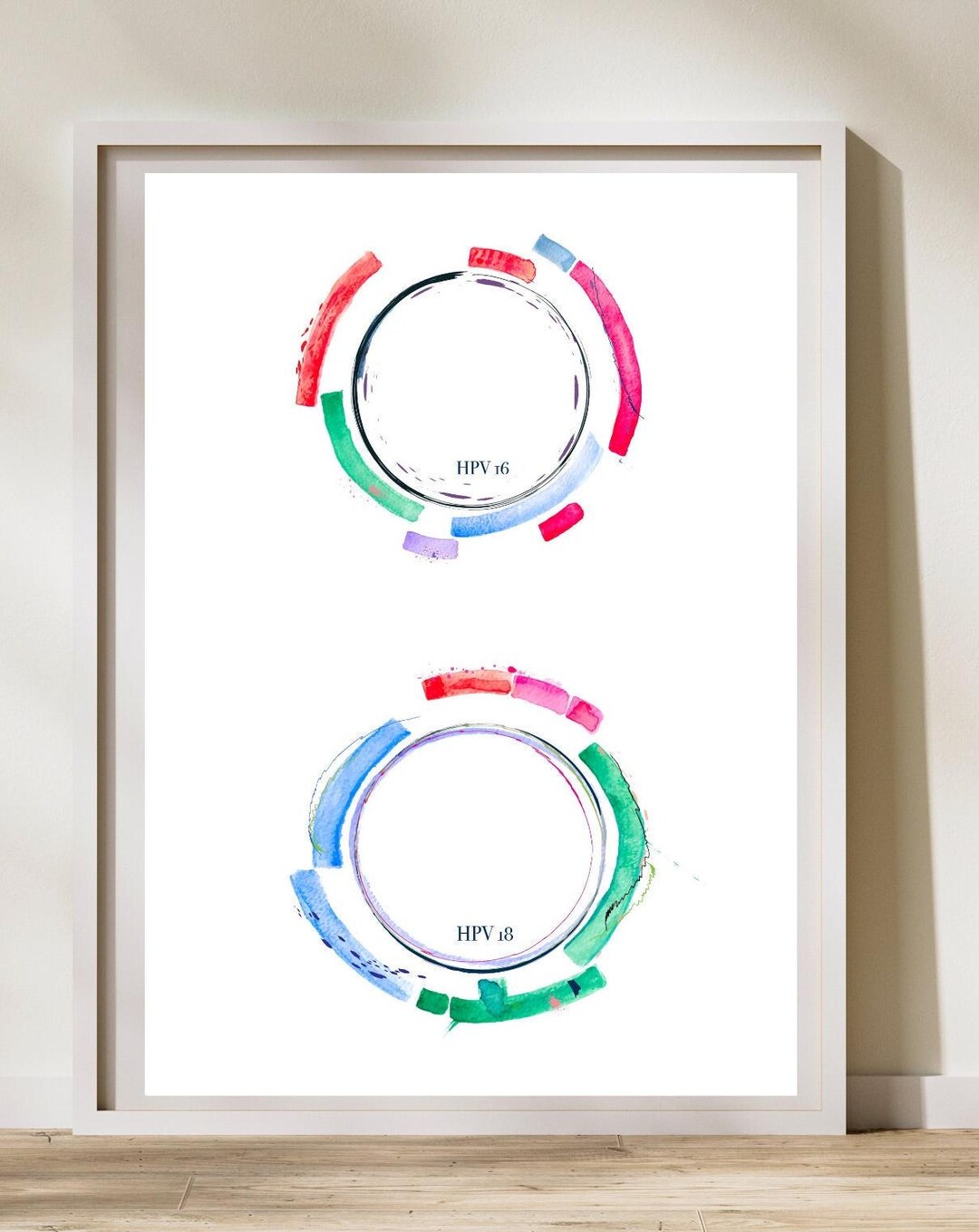HPV Virus Genome, Human Papillovirus Cervical Cancer, Dna Art Print ...