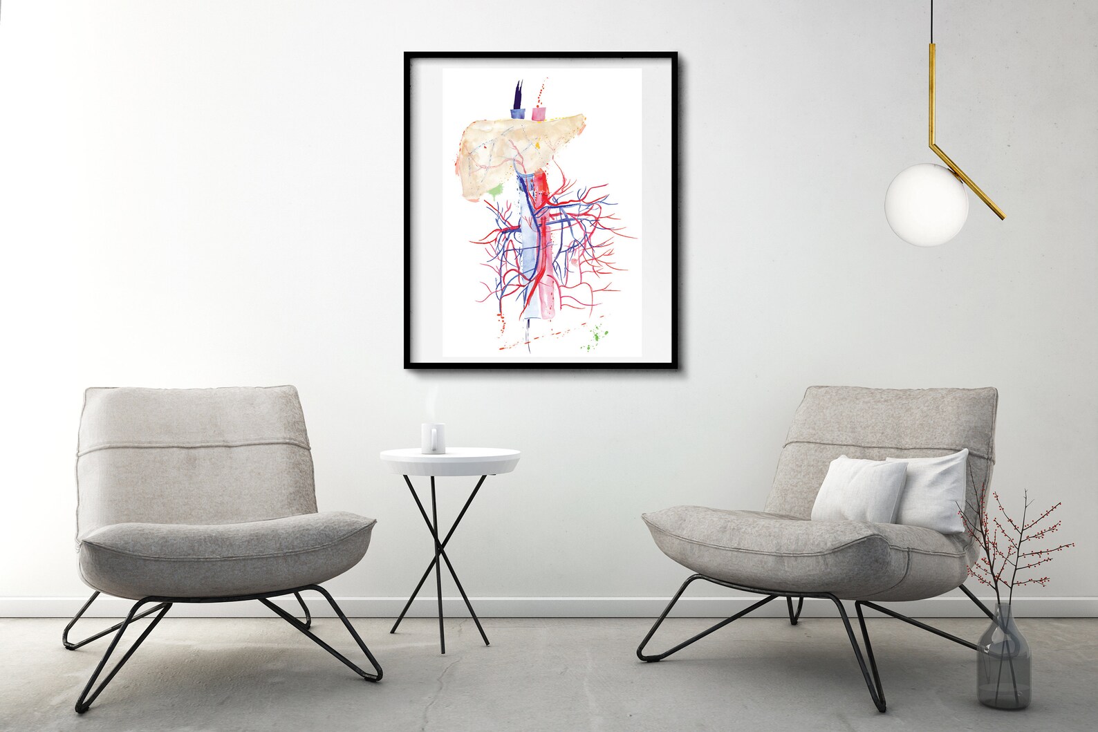 General Surgery Art Vascular Surgery Art Abdominal Arteries - Etsy