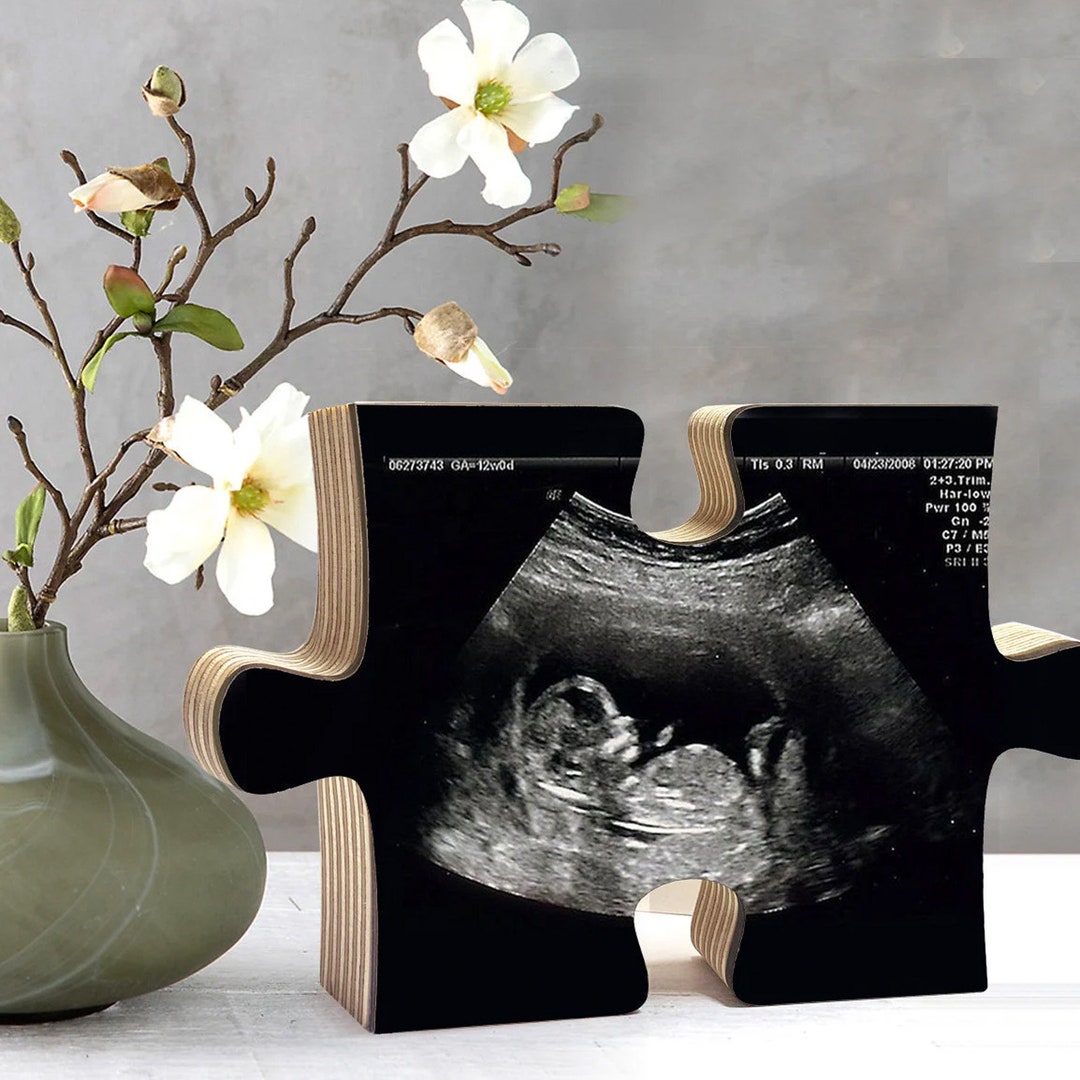 Sonogram Picture Frame for Parents Ultrasound Frame Babys - Etsy