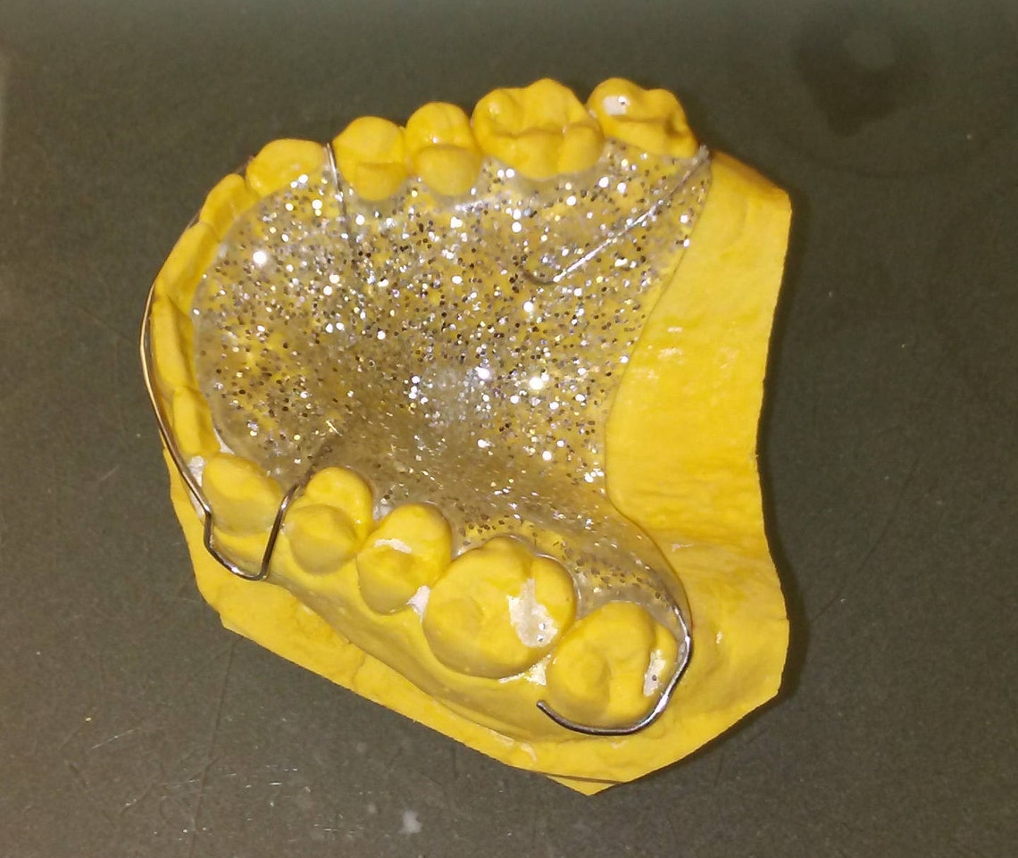 Orthodontic hawley retainer | Etsy