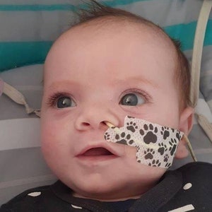 Ng Tube, Nasogastric or Oxygen Tube Adhesive Tape Length - Easter Egg ...