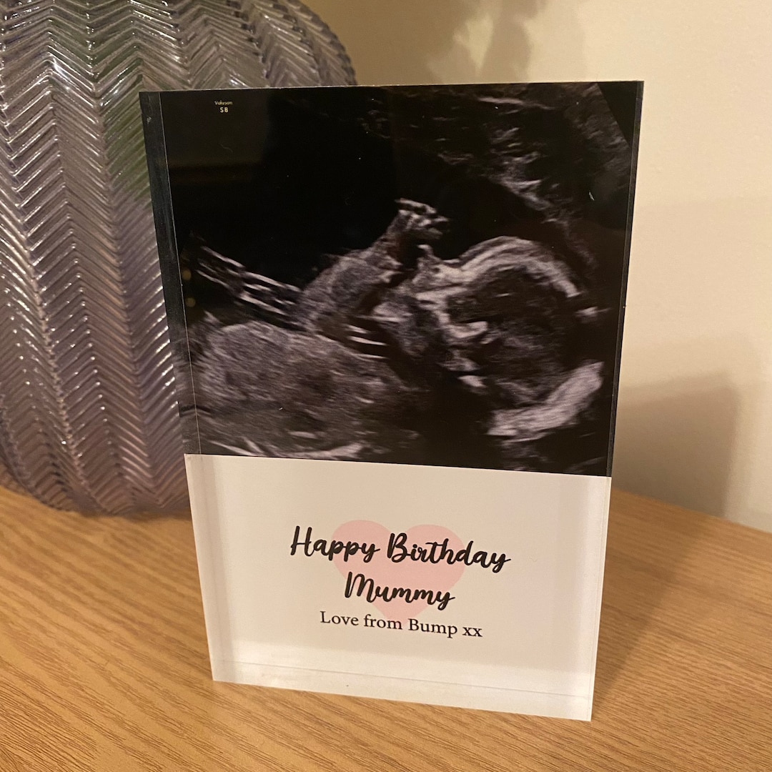 Personalised Birth Scan Block, Acrylic Photo Block, Personalised Photo ...