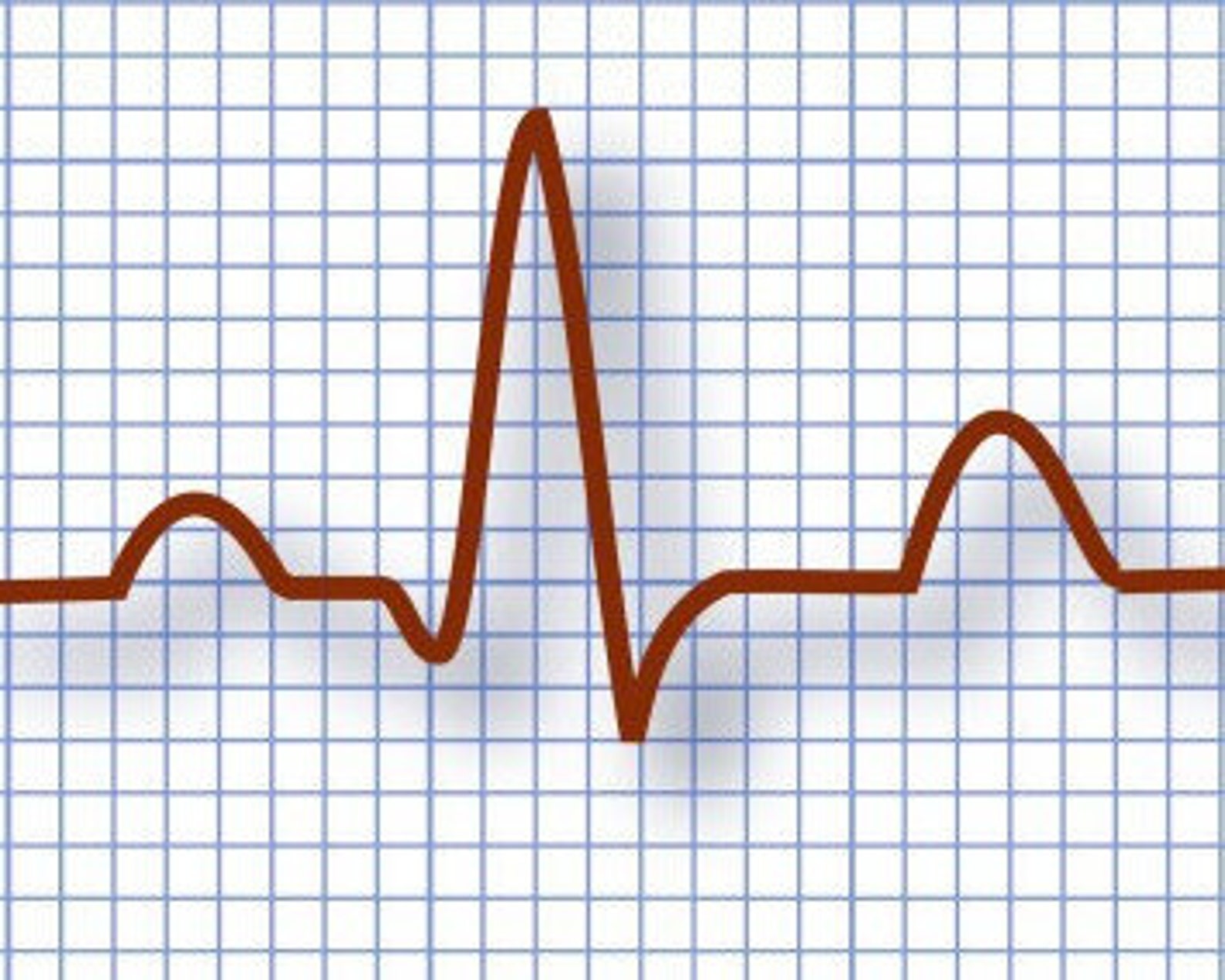 Accurate Ekg Heartbeat Ring -14K Gold /rose Gold-filled /sterling ...