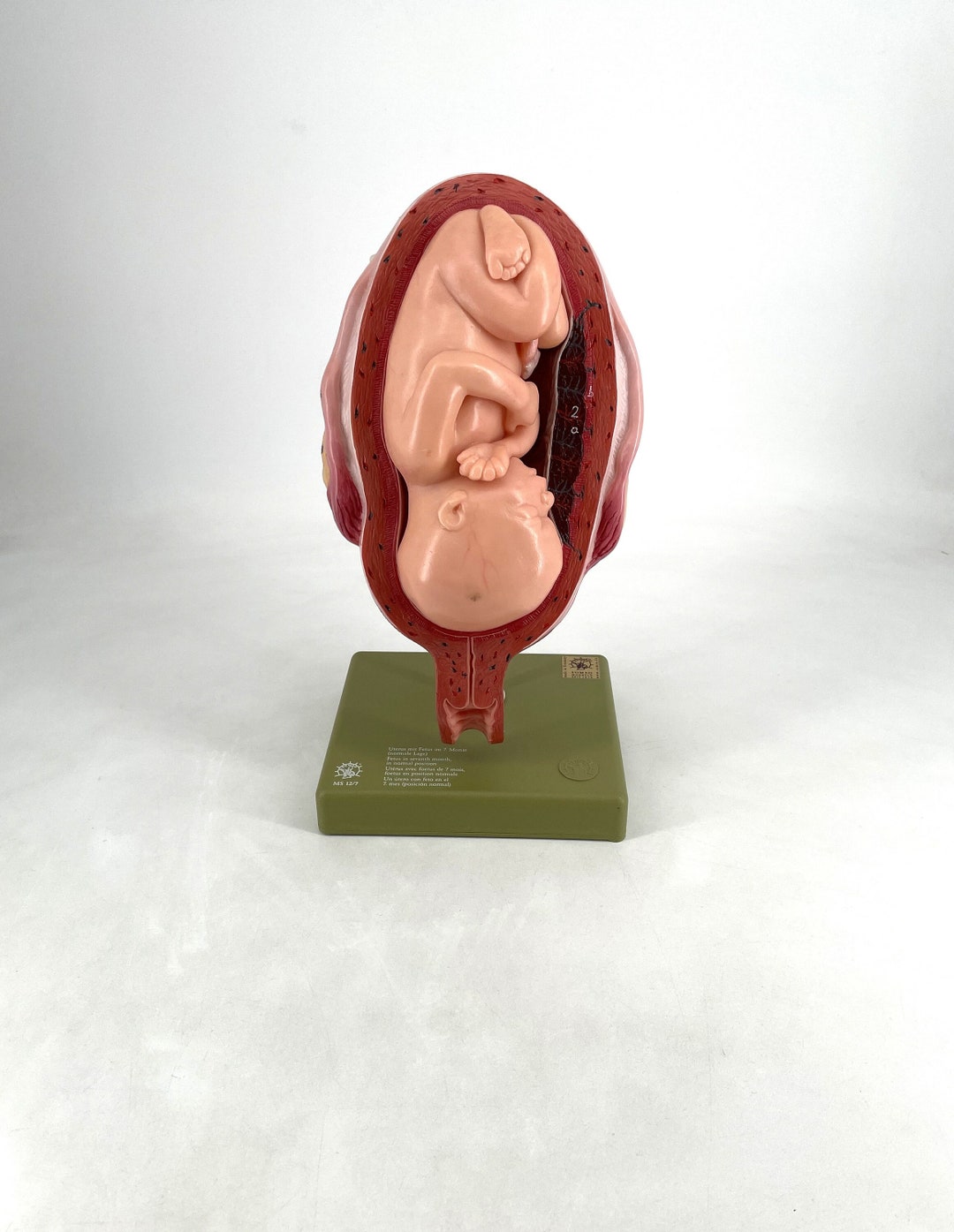 Vintage 1980s Somso Uterus With Fetus 7 Months Educational Anatomical ...