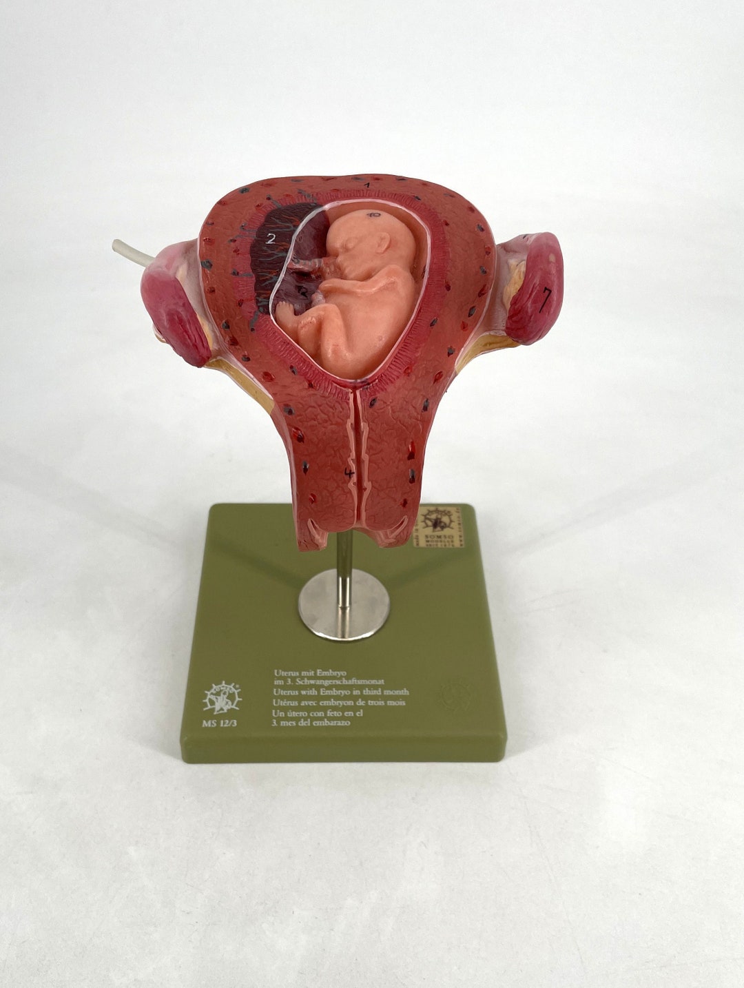 Vintage 1980s Somso Uterus With Fetus 3 Months Educational Anatomical ...
