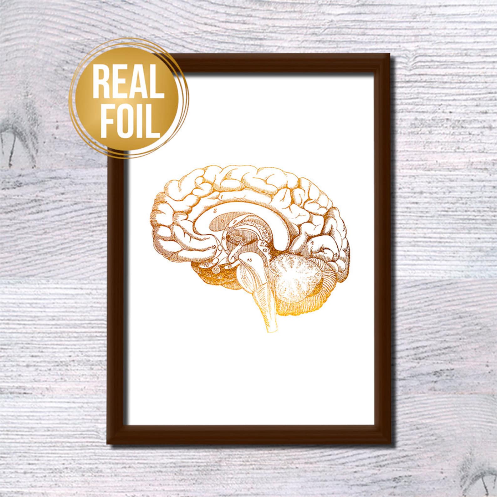 Human Brain Poster Gold Foil Human Brain Medical Print Anatomy | Etsy