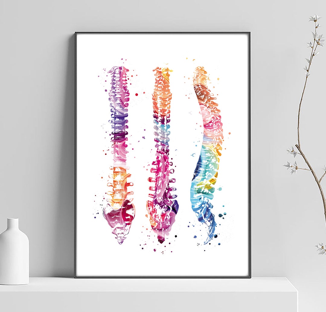 Medical Art, Spine Poster, Clinical Art, Doctor Decor, Surgery Art ...