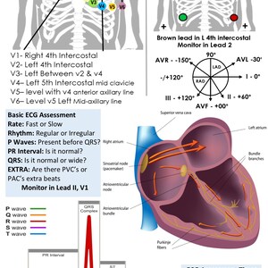 Brainsheet Book Pocket Brain Sheet Clinical Book Nursing Student Gift ...