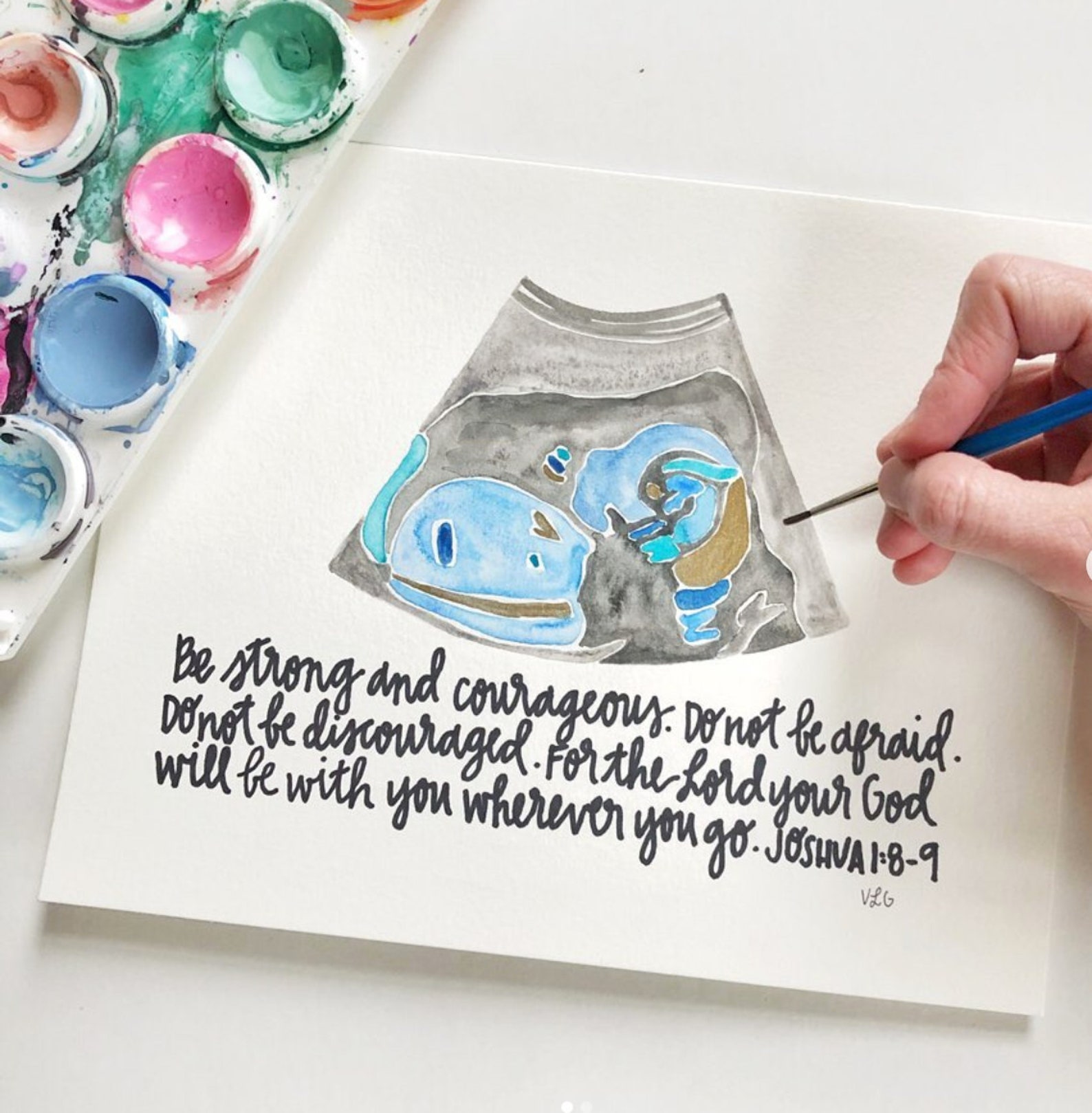 Watercolor Ultrasound Sonogram Painting Custom Ultrasound | Etsy