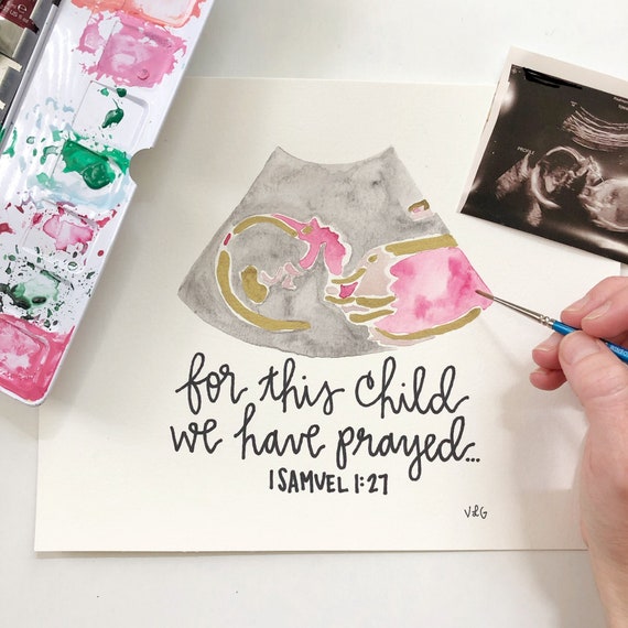 Watercolor Ultrasound Sonogram Painting Custom Ultrasound | Etsy