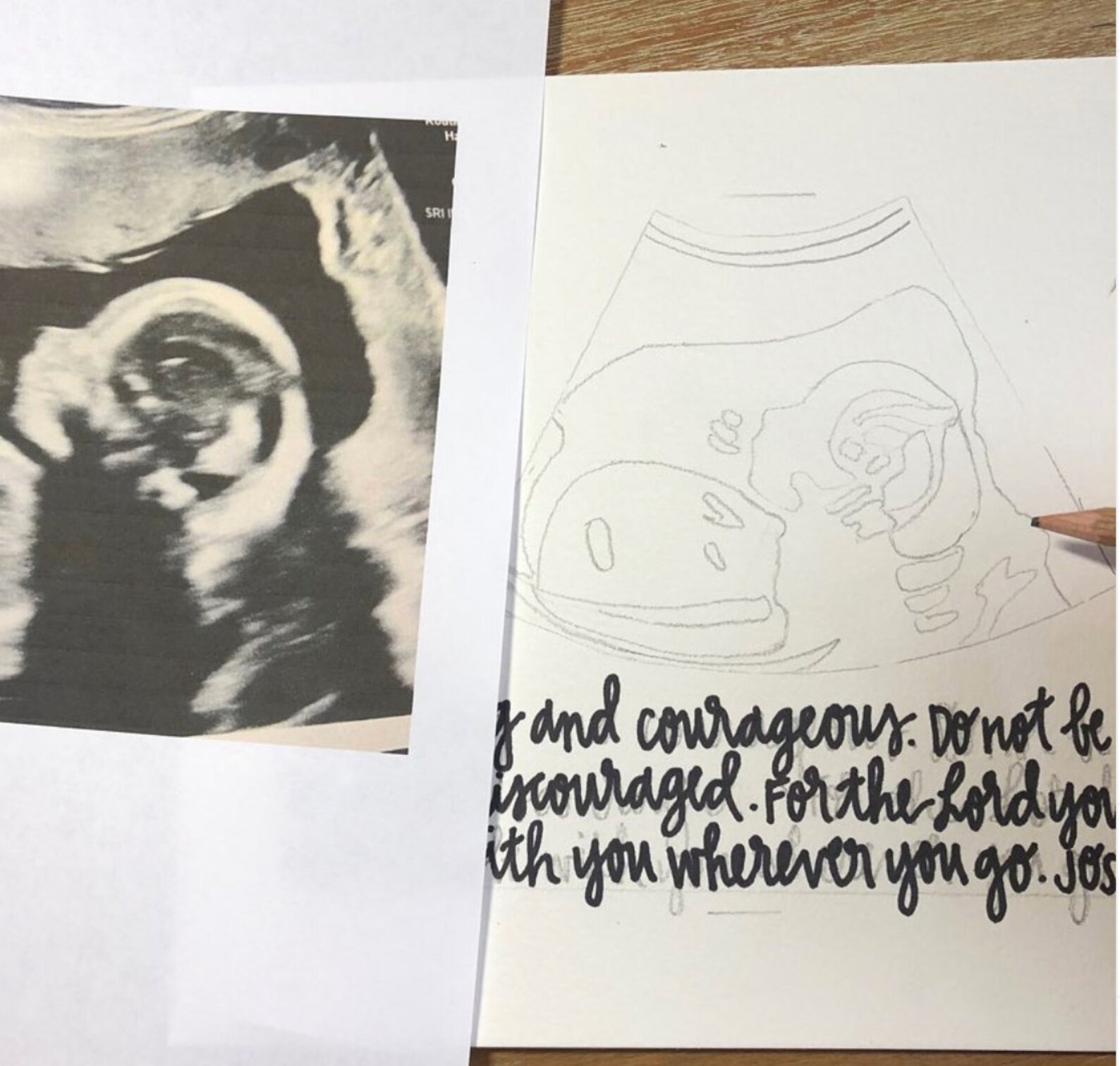 Watercolor Ultrasound Sonogram Painting Custom Ultrasound | Etsy