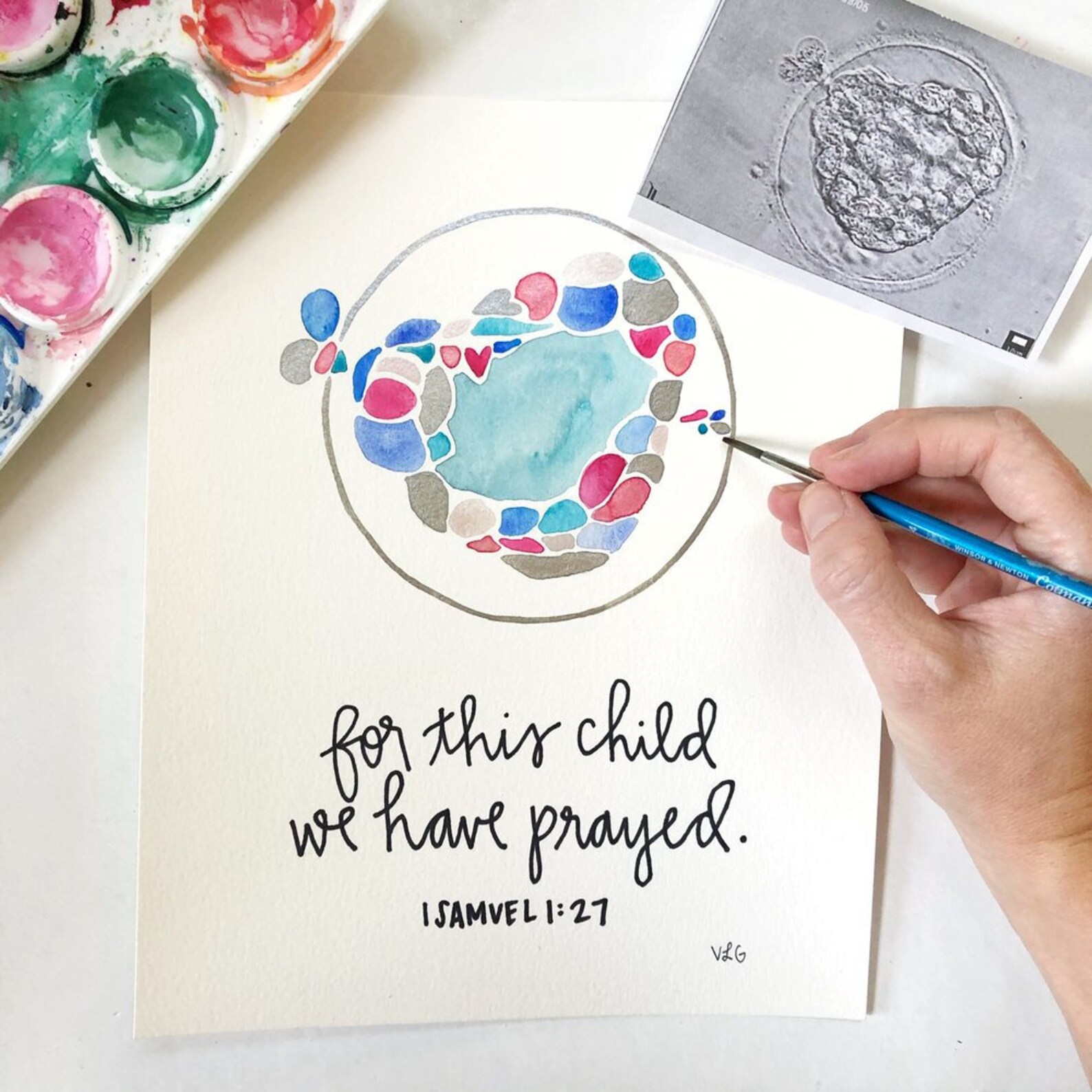 Embryo Painting Art Watercolor Blastocyst Custom Personalized - Etsy