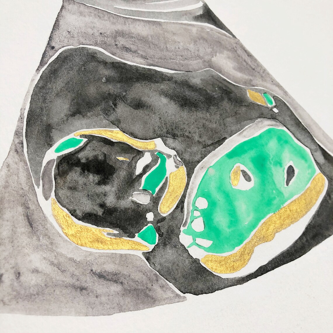 Watercolor Ultrasound Sonogram Painting Custom Ultrasound | Etsy