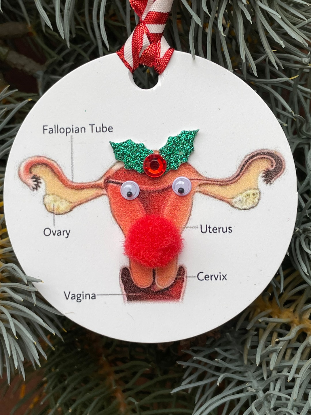 UTERUS Ornament- Gifts for Obgyn/hysterectomy/ Nurse Midwife/ Doula ...