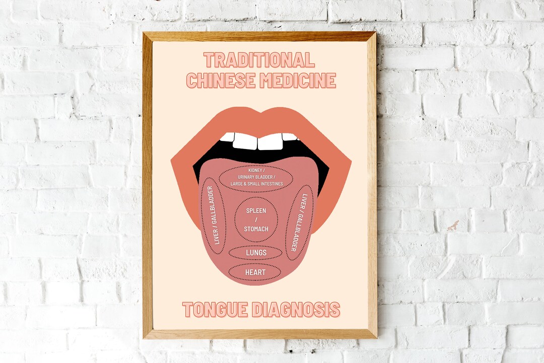 TCM Study Guide, Traditional Chinese Medicine, Tongue Diagnosis ...