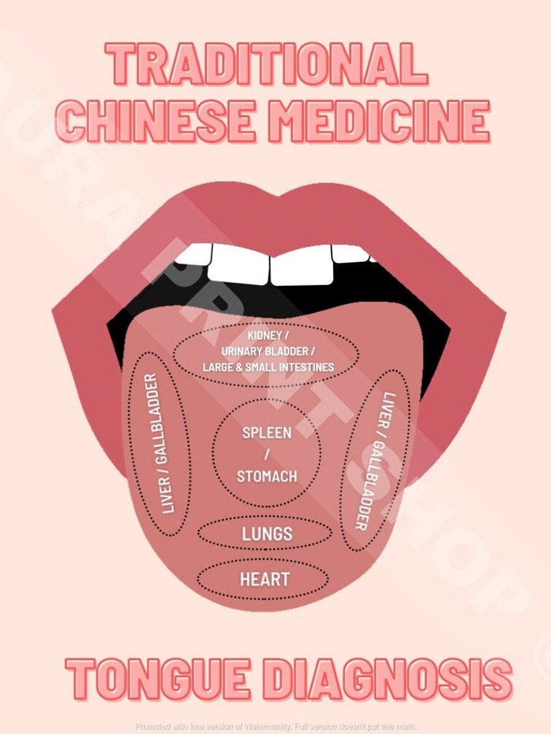 TCM Study Guide, Traditional Chinese Medicine, Tongue Diagnosis ...