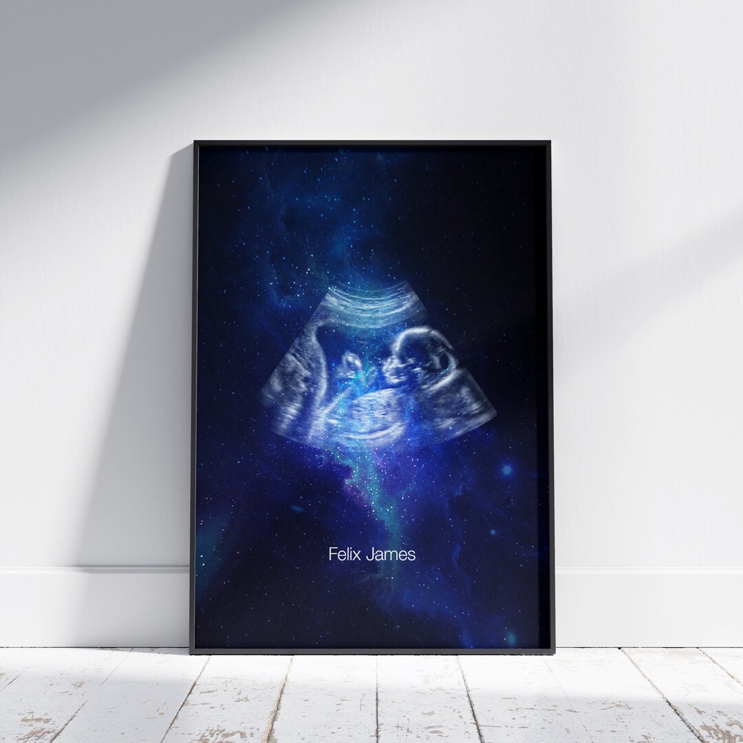 Ultrasound Art Stillborn Memorial Baby Scan Stillbirth Memorial Baby ...