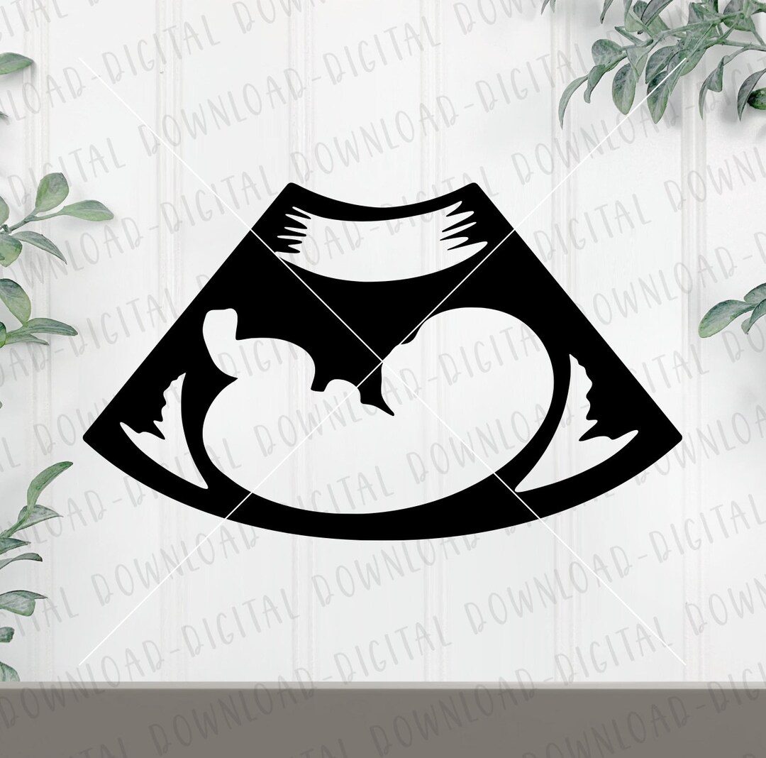 Sonogram Svg, Pregnancy Svg - Etsy