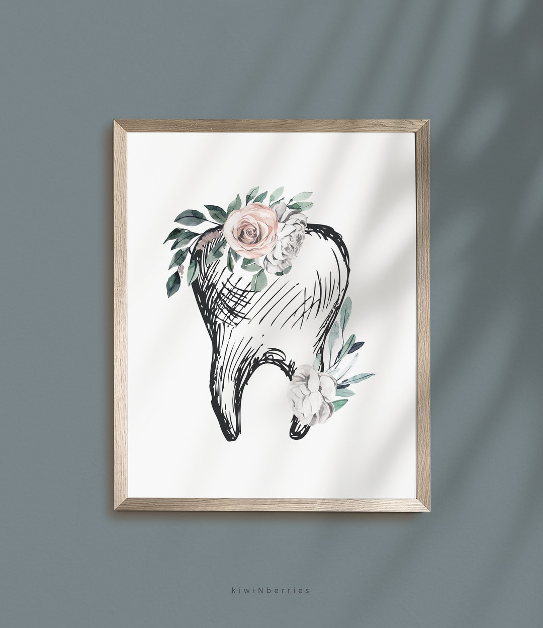 Molar Print, Dental Center Wall Art, Teeth Poster, Dentist Office ...