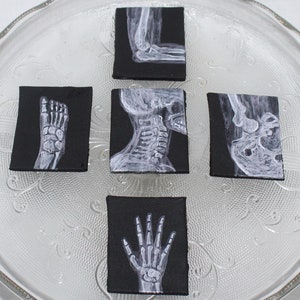 Fondant X-ray Cake Topper - Fondant Radiology - Fondant Medical ...