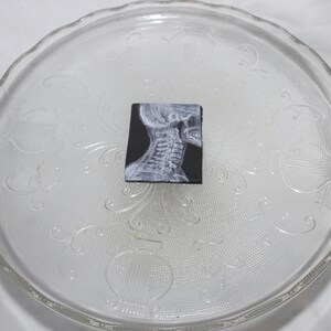 Fondant X-ray Cake Topper - Fondant Radiology - Fondant Medical ...