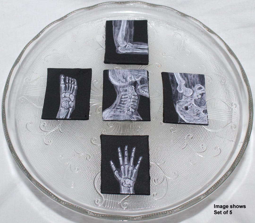 Fondant X-ray Cake Topper - Fondant Radiology - Fondant Medical ...