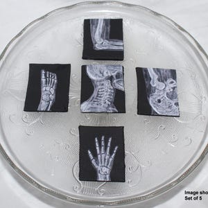 Fondant X-ray Cake Topper - Fondant Radiology - Fondant Medical ...