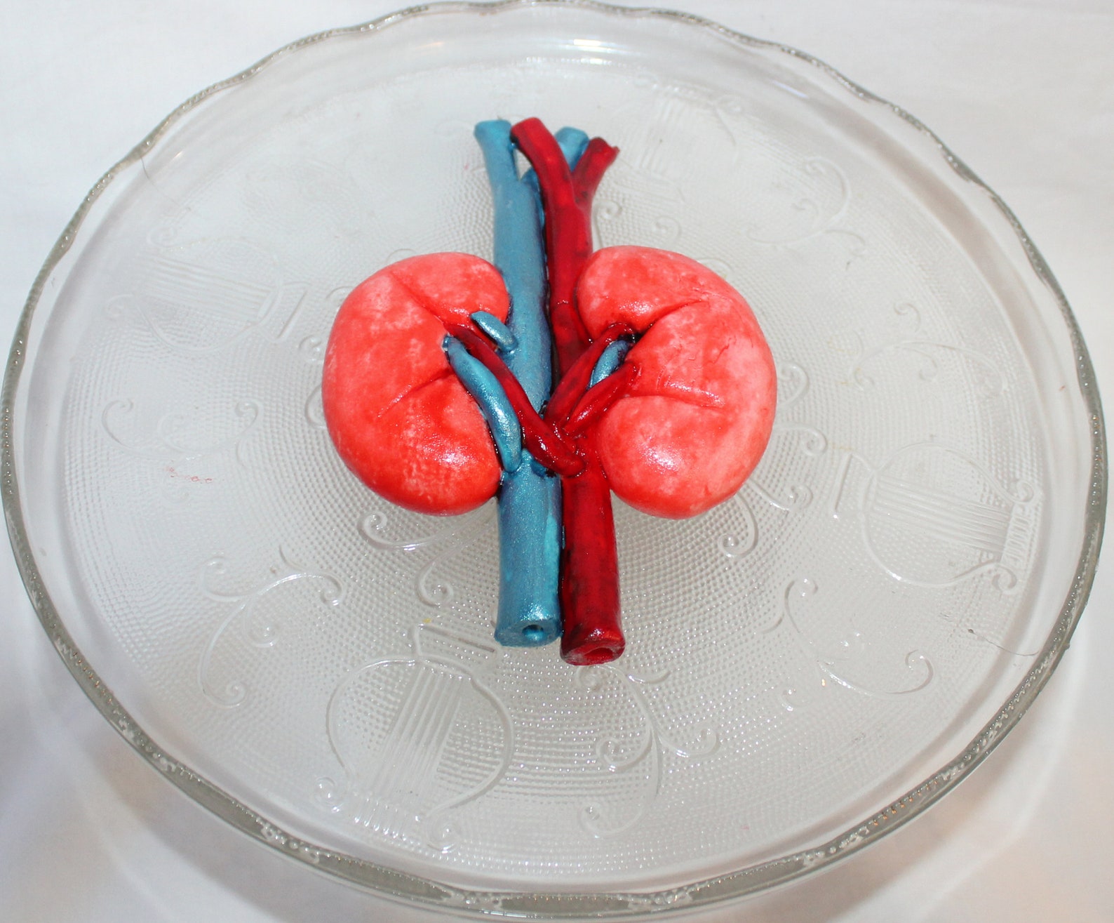 Fondant Medical Cake Topper - Fondant Kidney - Kidney Topper - Fondant ...