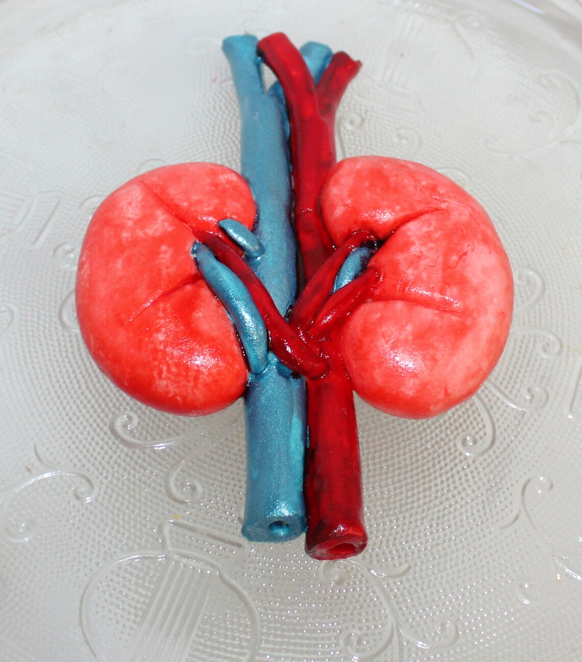 Fondant Medical Cake Topper - Fondant Kidney - Kidney Topper - Fondant ...