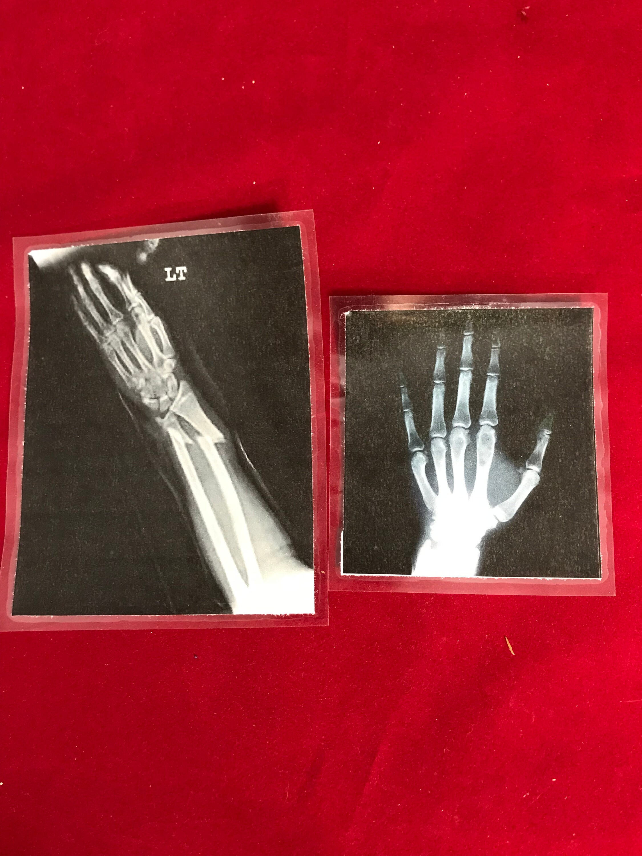 Doll Hospital Accessories - Chart, IV Bag, Eye Chart and X-rays for ...