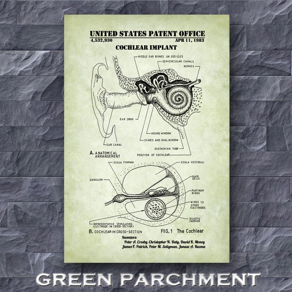 Cochlear Implant Diagram