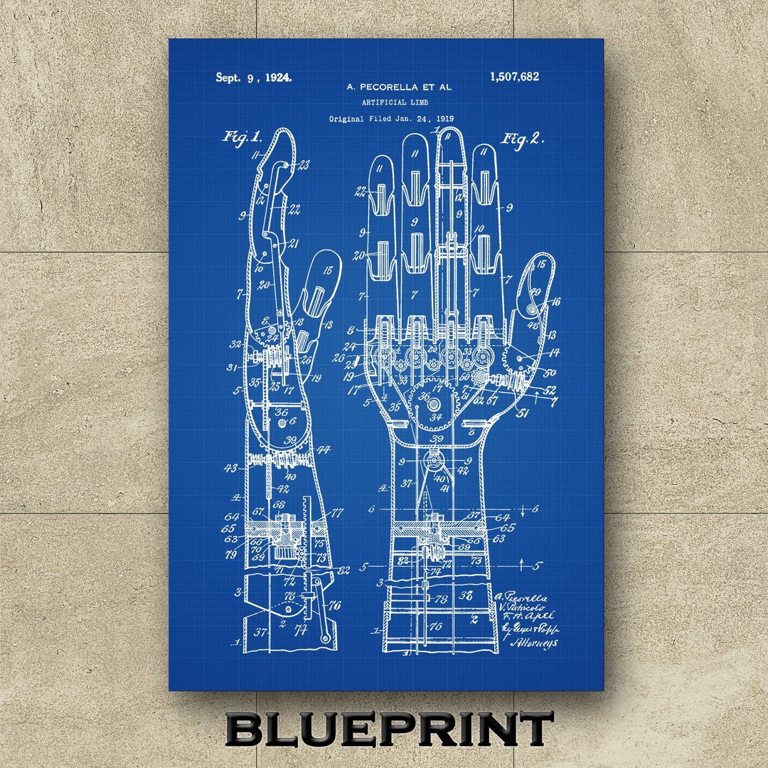 Artificial Hand Patent Prosthetic Poster Hand Poster Bionic - Etsy ...