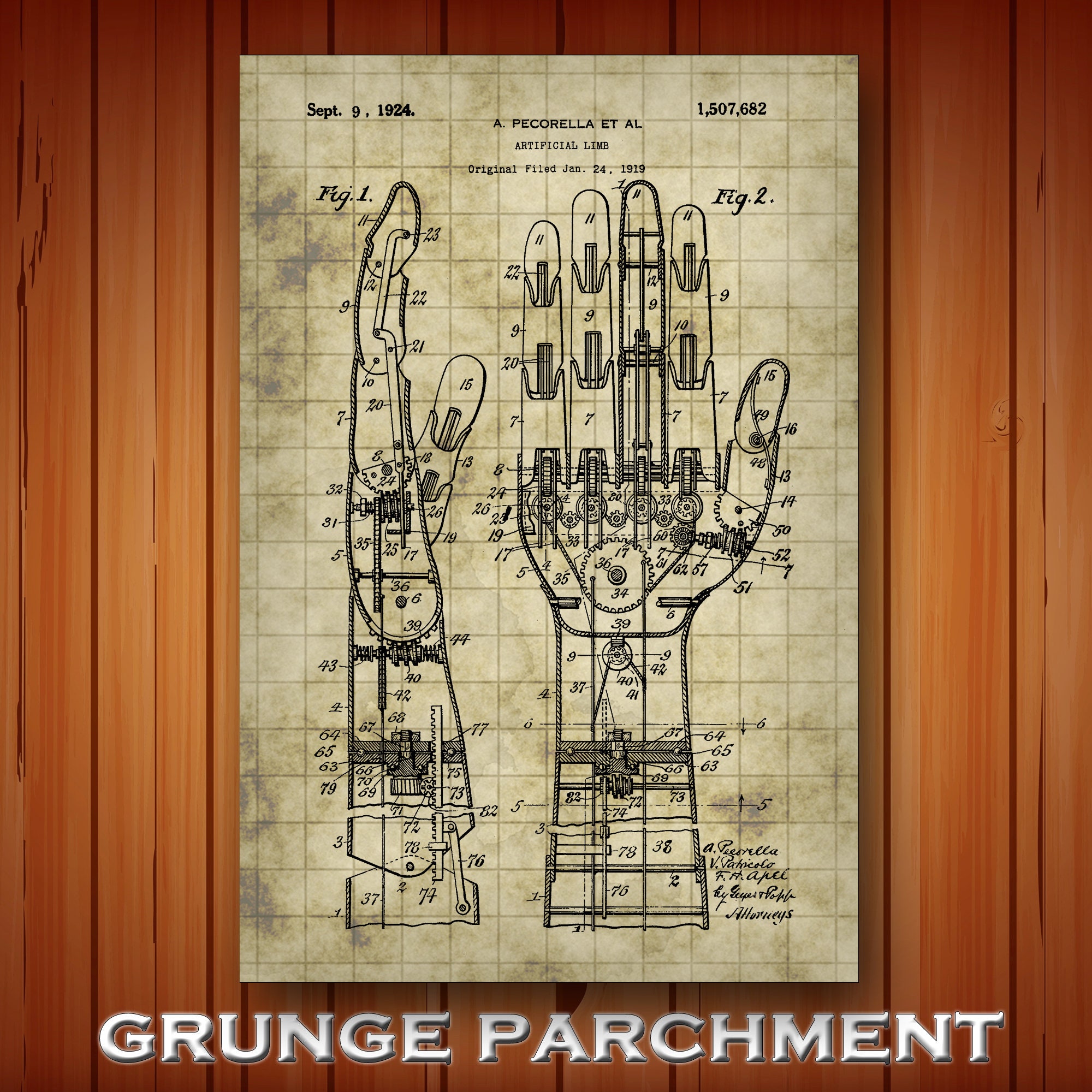 Artificial Hand Patent Prosthetic Poster Hand Poster Bionic | Etsy ...