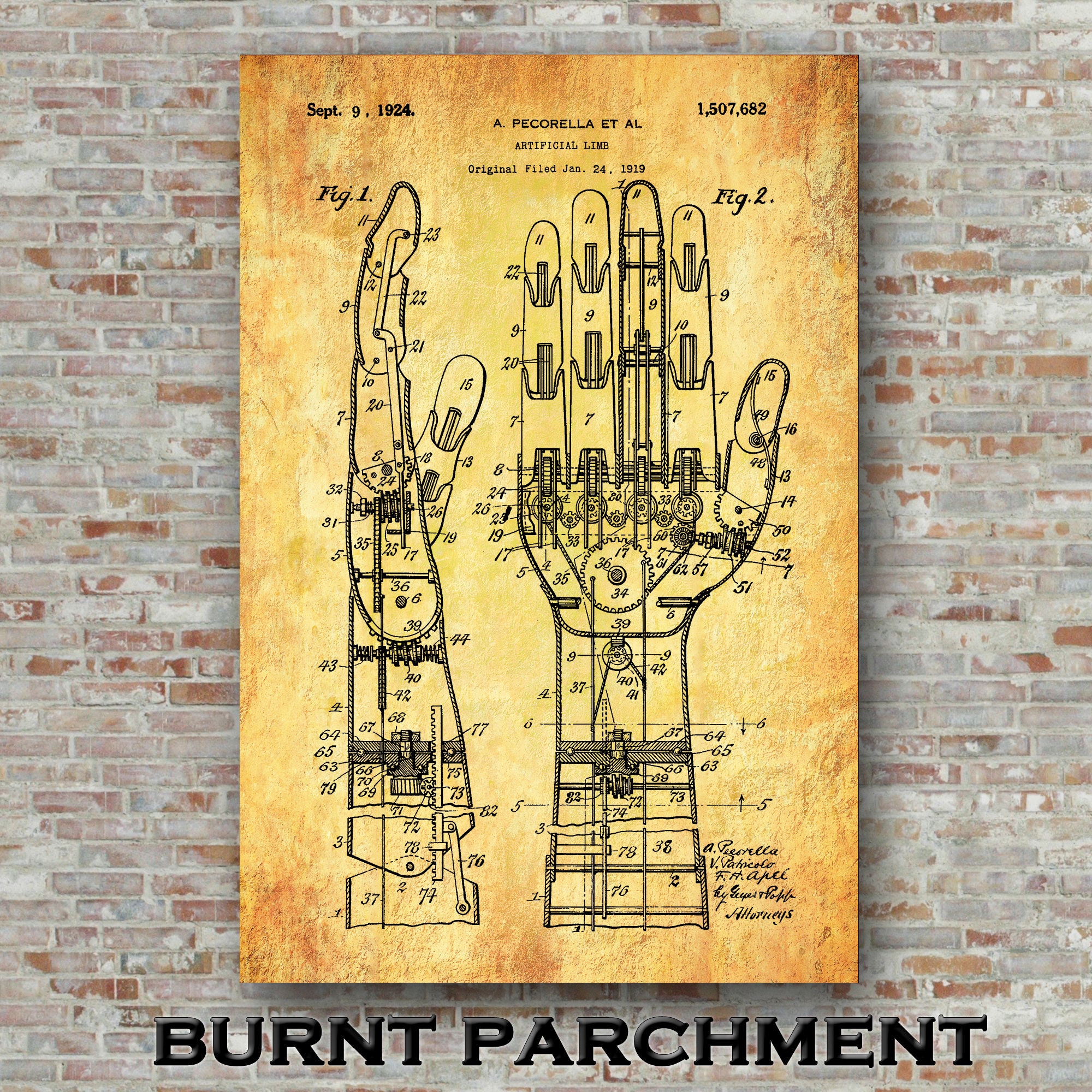 Artificial Hand Patent Prosthetic Poster Hand Poster Bionic - Etsy ...