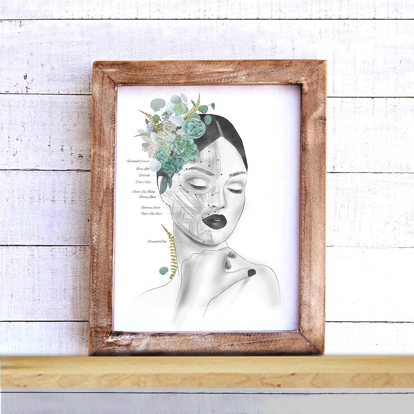 Botox Injection Points Art Esthetician Print Dermatology - Etsy