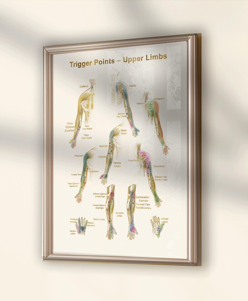 Trigger Points Charts Bundle – Digital Download Anatomy Poster Set for ...