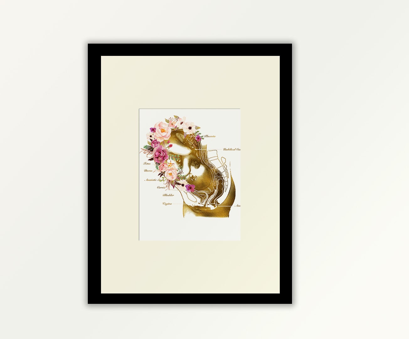 Pregnancy Print Midwife Gift Obstetric Art Gynecology - Etsy