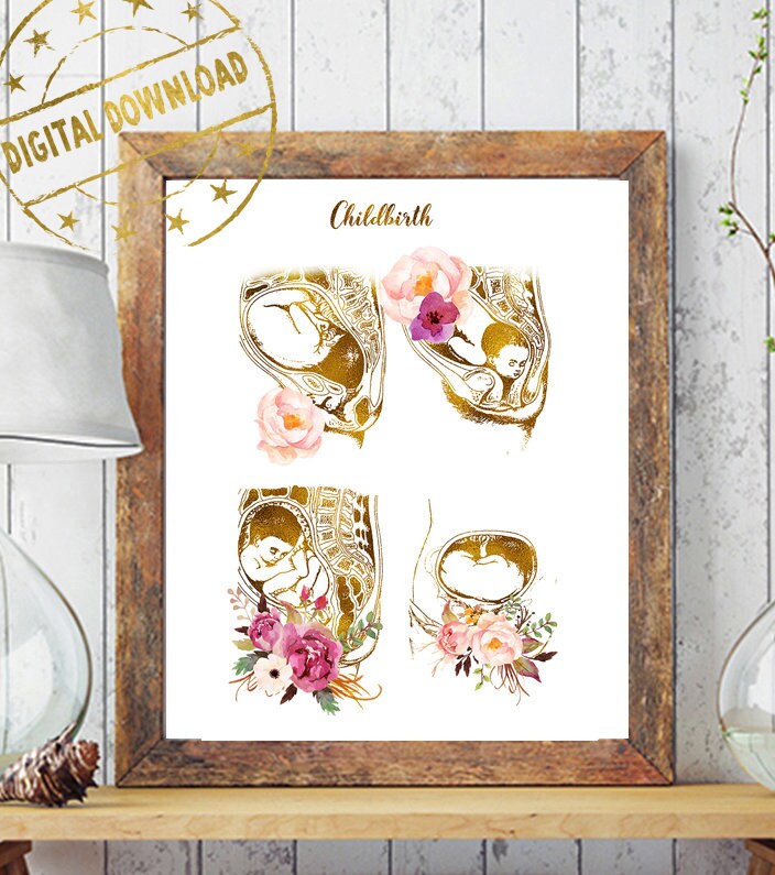 Midwife Print Printable Art Obgyn Art Print Midwife Office | Etsy